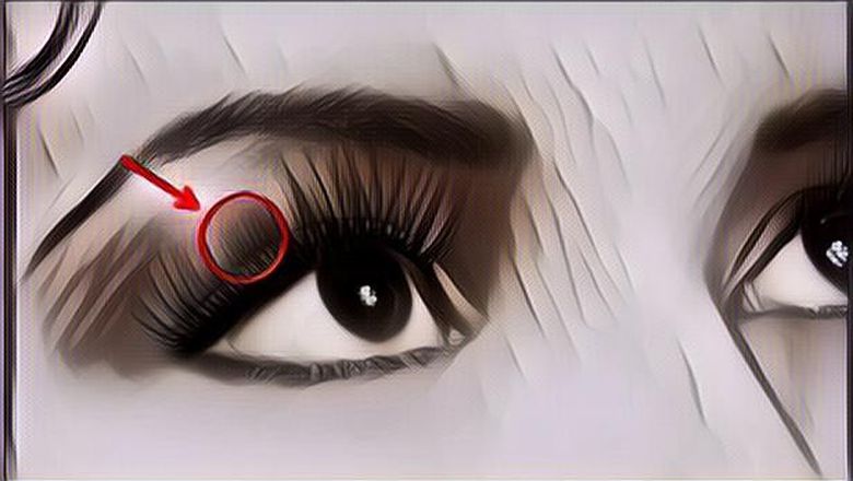 Kedutan Mata Kanan Atas Artinya Apa? Berikut Penjelasan Medisnya ...